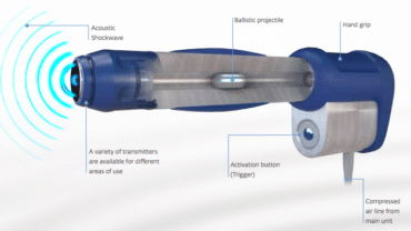 Shockwave Therapy - Performance Chiropractic + Physiotherapy